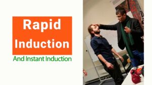 Rapid Induction Hypnosis (Why it is good and must be used)